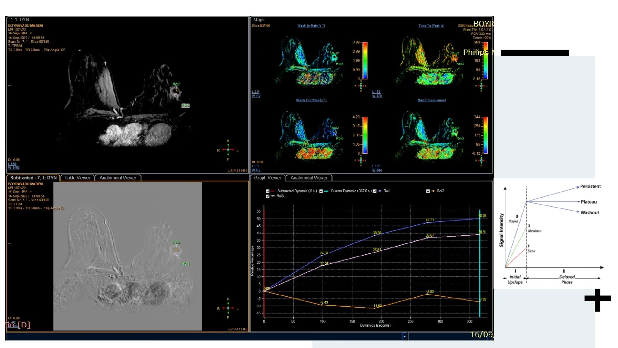 Multimodality imaging of the breast- BI-RADS | PPTX