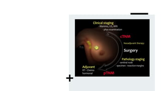 Multimodality imaging of the breast- BI-RADS | PPTX