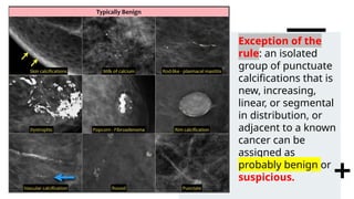 Multimodality imaging of the breast- BI-RADS | PPTX