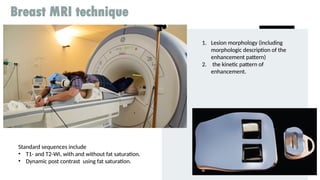 Multimodality imaging of the breast- BI-RADS | PPTX