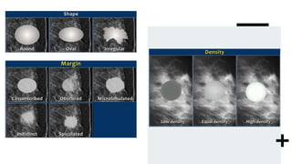 Multimodality imaging of the breast- BI-RADS | PPTX