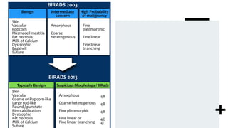 Multimodality imaging of the breast- BI-RADS | PPTX