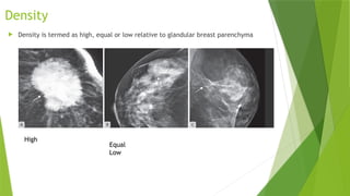 BREAST IMAGING OF ABNORMAL BREAST LESION AND USG GUIDED INTERVENTION | PPTX