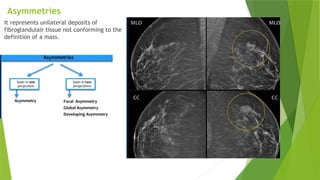 BREAST IMAGING OF ABNORMAL BREAST LESION AND USG GUIDED INTERVENTION | PPTX