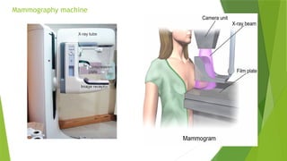 BREAST IMAGING OF ABNORMAL BREAST LESION AND USG GUIDED INTERVENTION | PPTX