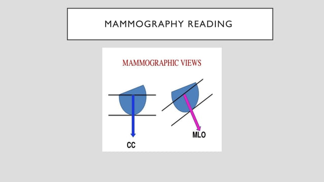 BREAST IMAGING REPORTING AND DATA SYSTEM (BIRADS.pptx