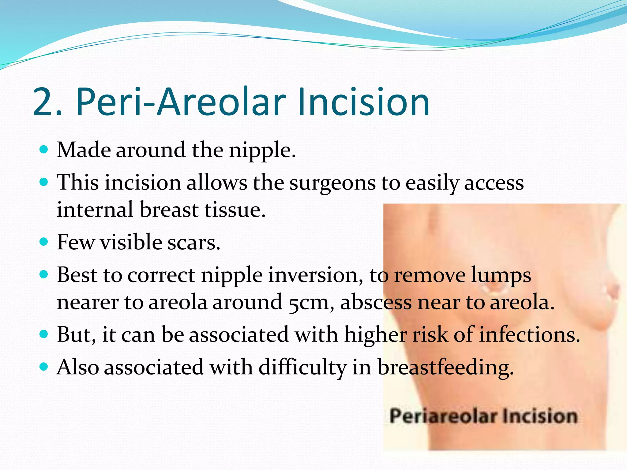 Breast incisions | PPTX
