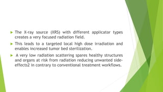 intrabeam intraoperative radiotherapy | PPTX