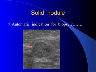 Breast lecture | PPT