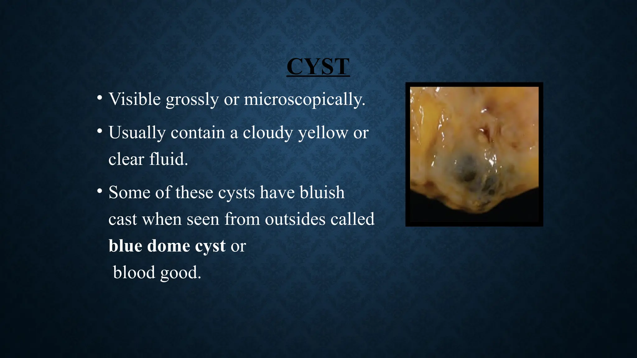 breast lesions and their histo pathology.pptx