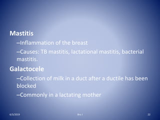 Breast lumps dr tuse | PPTX