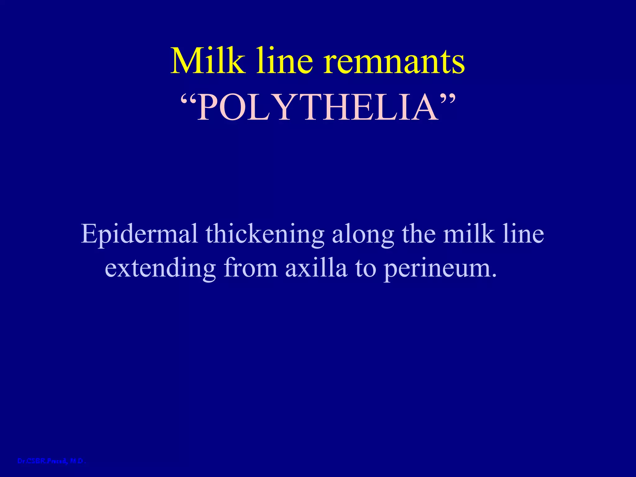 Breast pathology 1 | PDF