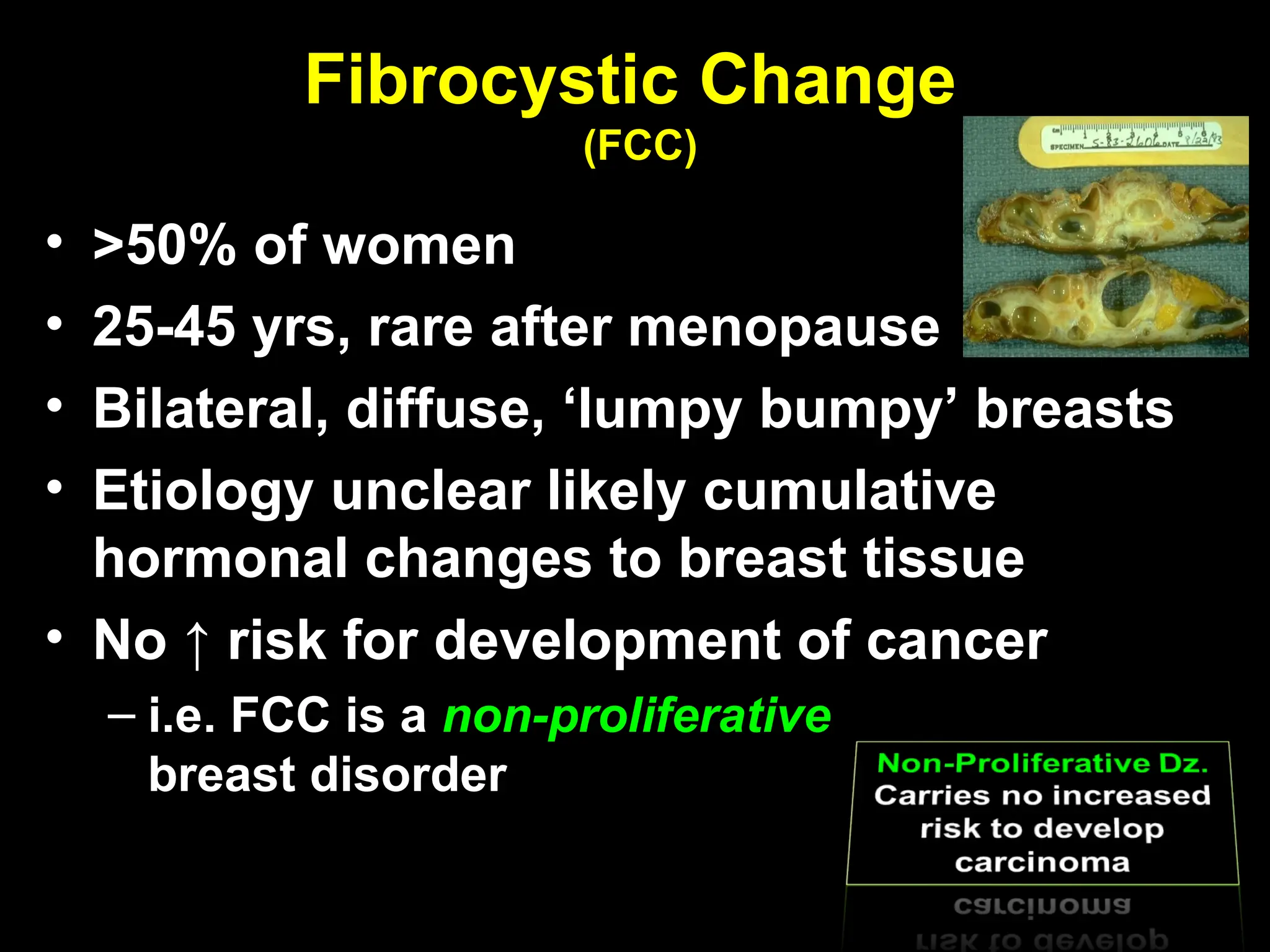Breast Pathology Clinical Pathology Study Questions_Mari-Alina Timoshchuk.ppt
