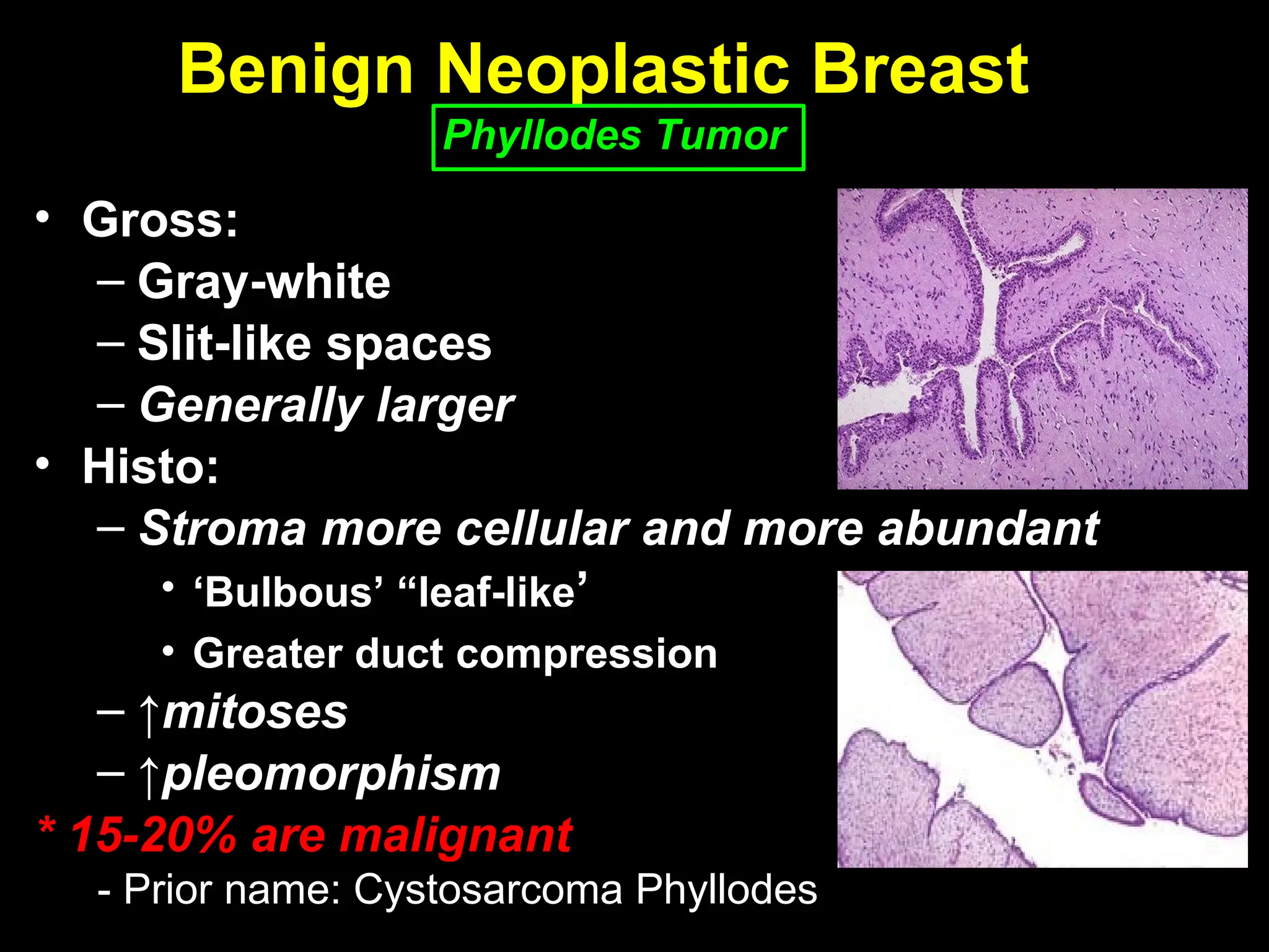 Breast Pathology Clinical Pathology Study Questions_Mari-Alina Timoshchuk.ppt