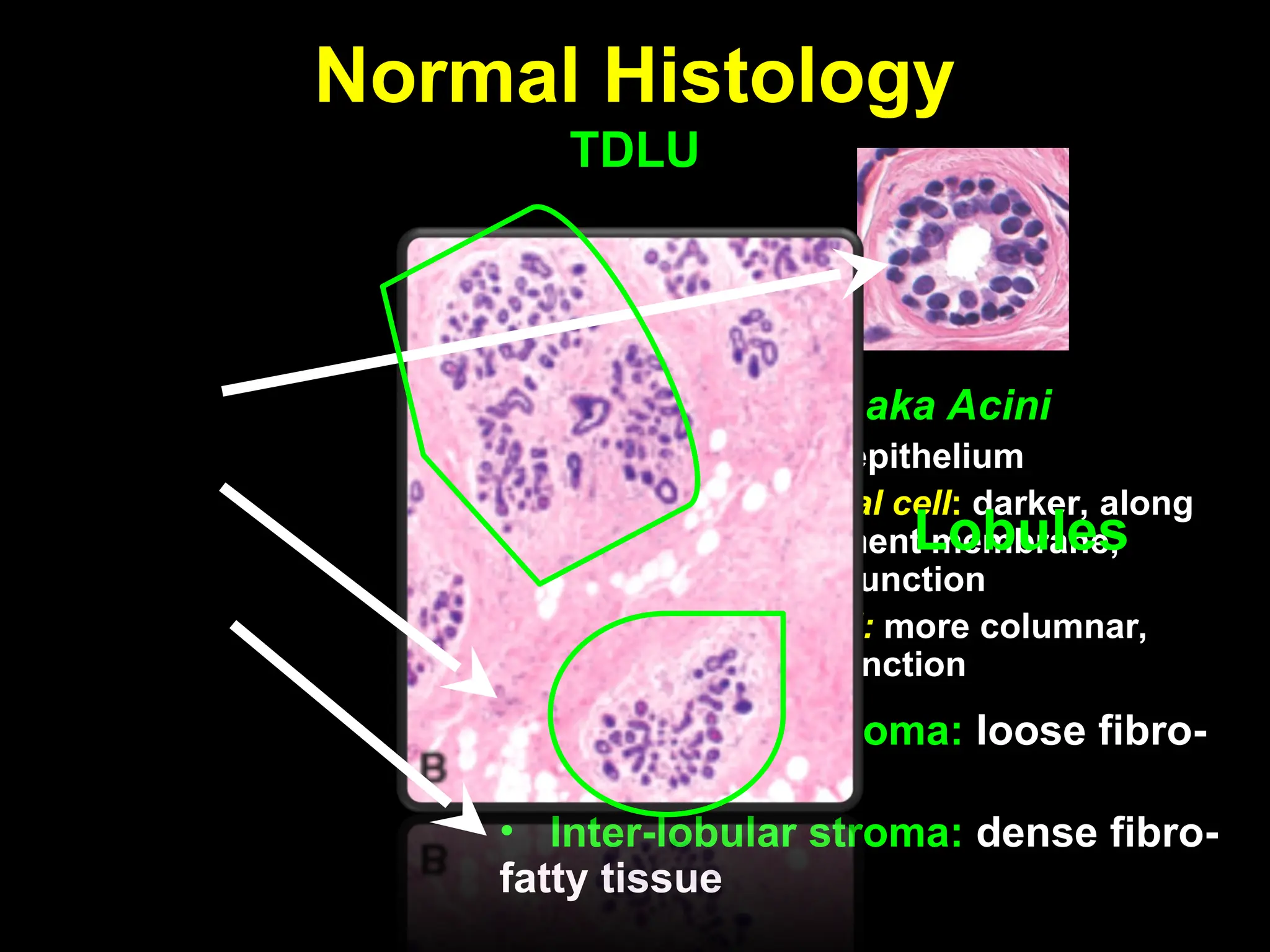 Breast Pathology Clinical Pathology Study Questions_Mari-Alina Timoshchuk.ppt