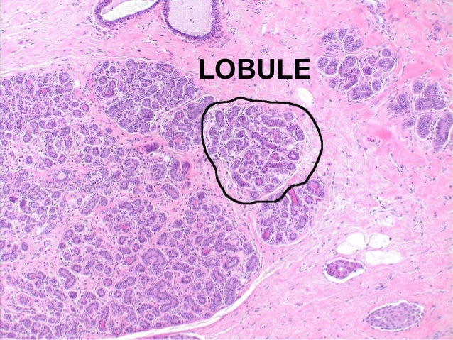 Breast pathology i march 15. 2015
