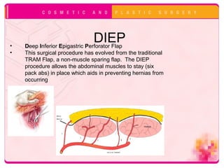 Breastrecon | PPT