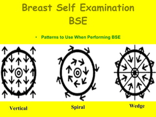 Breast Self Examination | PPT