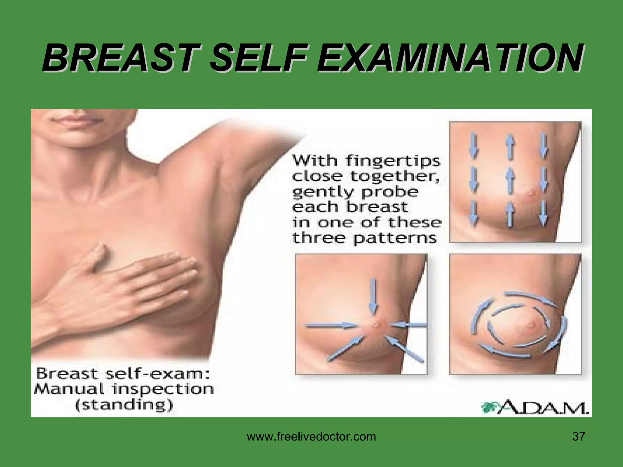 Breast self examination | PPT