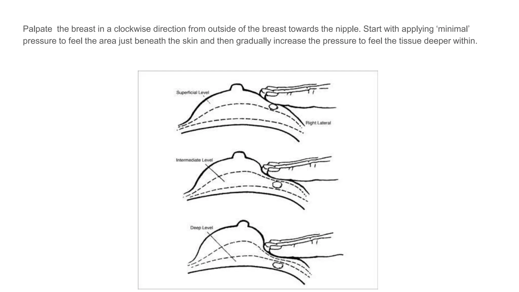 Breast self examination | PPTX