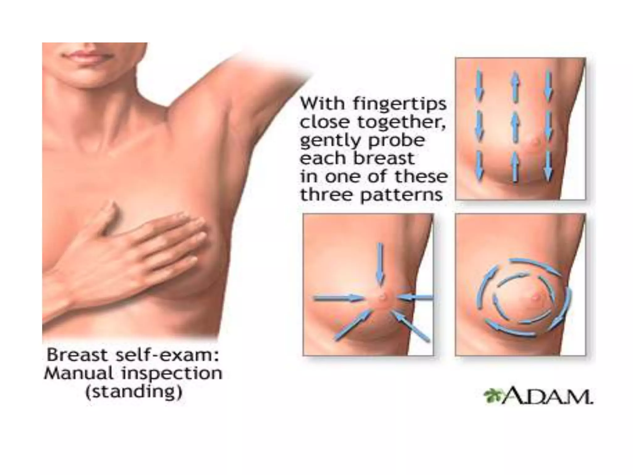 Breast self examination (bse) ppt | PPTX