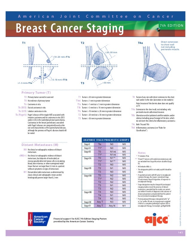 Breast Cancer Staging Ajcc