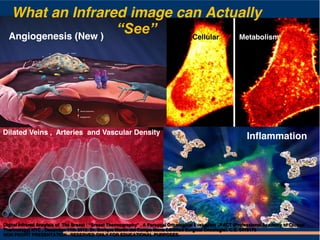 Breast Thermography /Digital Infrared Analysis of the Breast | PDF