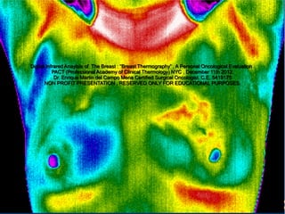 Breast Thermography /Digital Infrared Analysis of the Breast | PDF