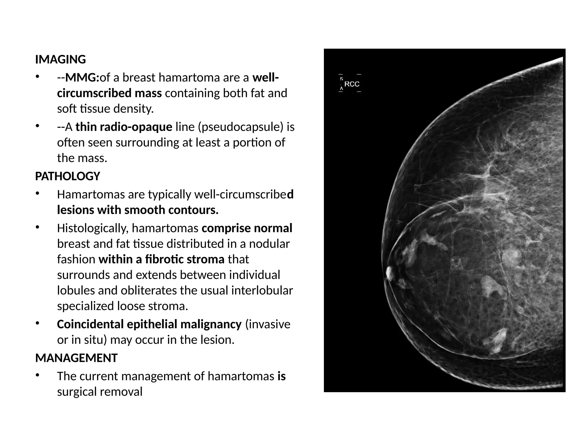 Breast_Tumours5367475377359276t2r24682466 | PPTX