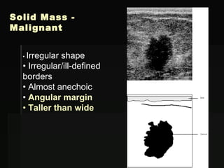 Breast ultrasound | PPT