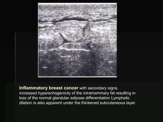 Breast ultrasound | PPT