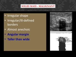 Breast_Ultrasound.pdfuuuuuuuuuuuuuuuuuuu | PDF