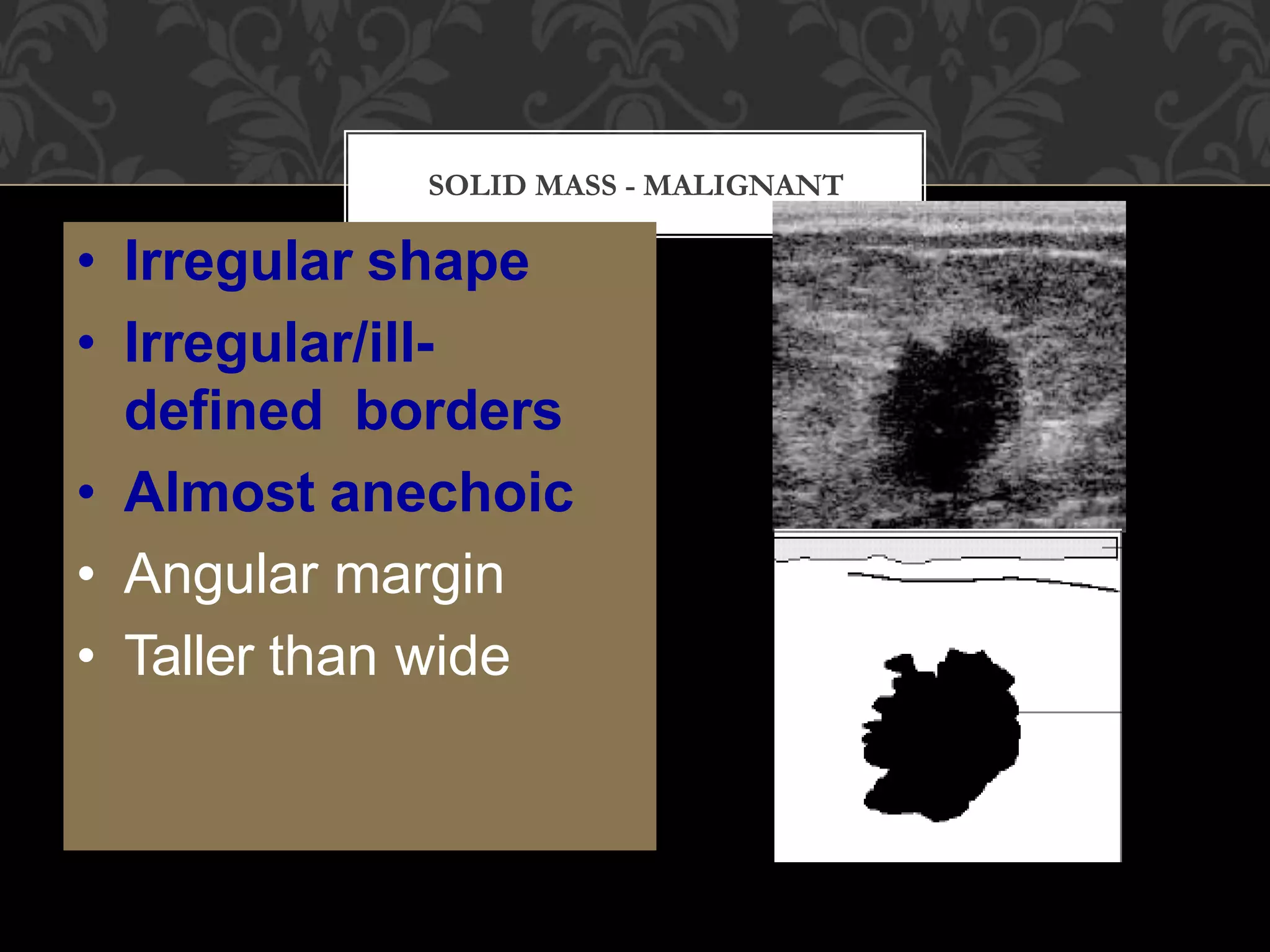 Breast ultrasound techniques | PPTX