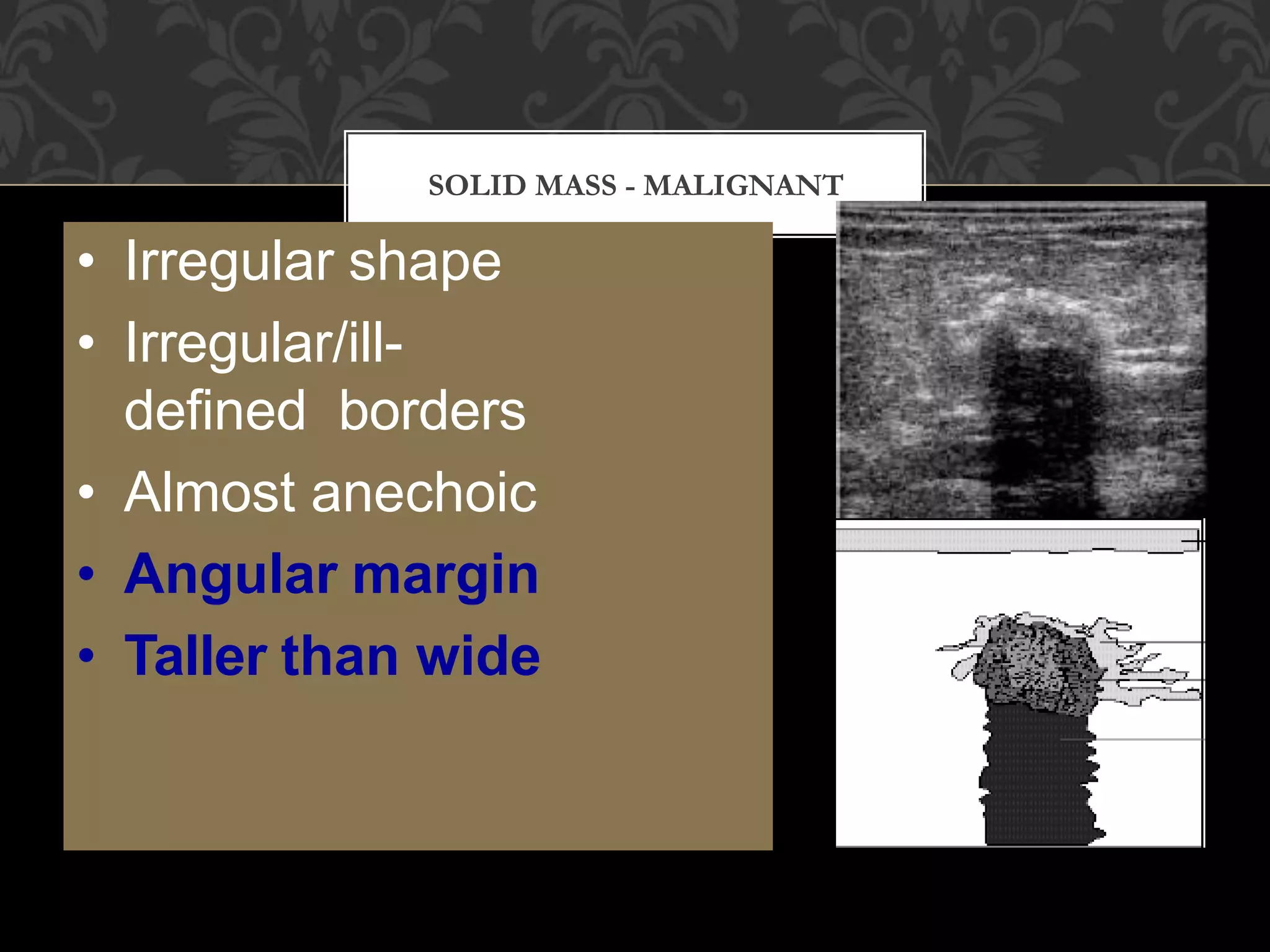 Breast ultrasound techniques | PPTX