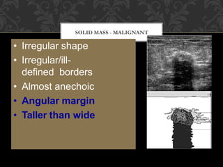Breast ultrasound techniques | PPTX