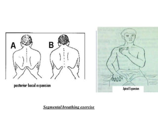 BREATHING EXERCISESAND ITS TYPES BY DR VANI FOR BPT STUDENTS | PPTX