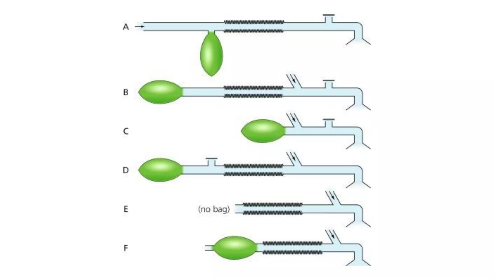 Breathing systems - Mapleson Classification | PDF