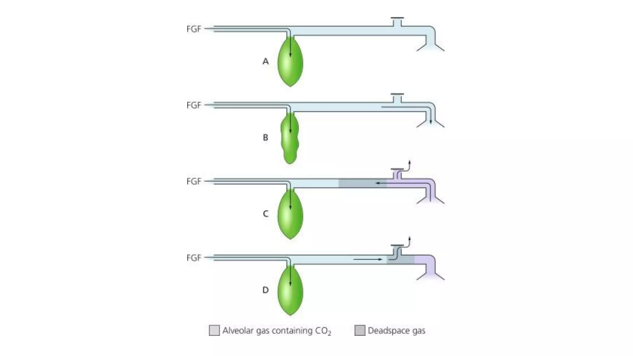 Breathing systems - Mapleson Classification | PDF