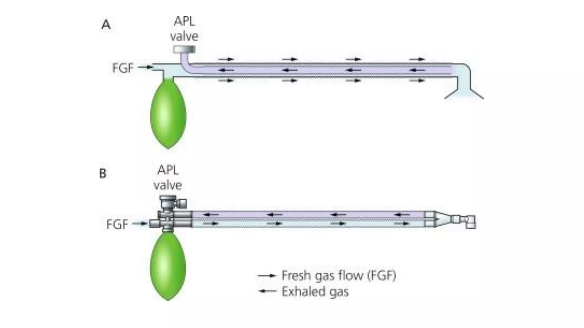 Breathing systems - Mapleson Classification | PDF