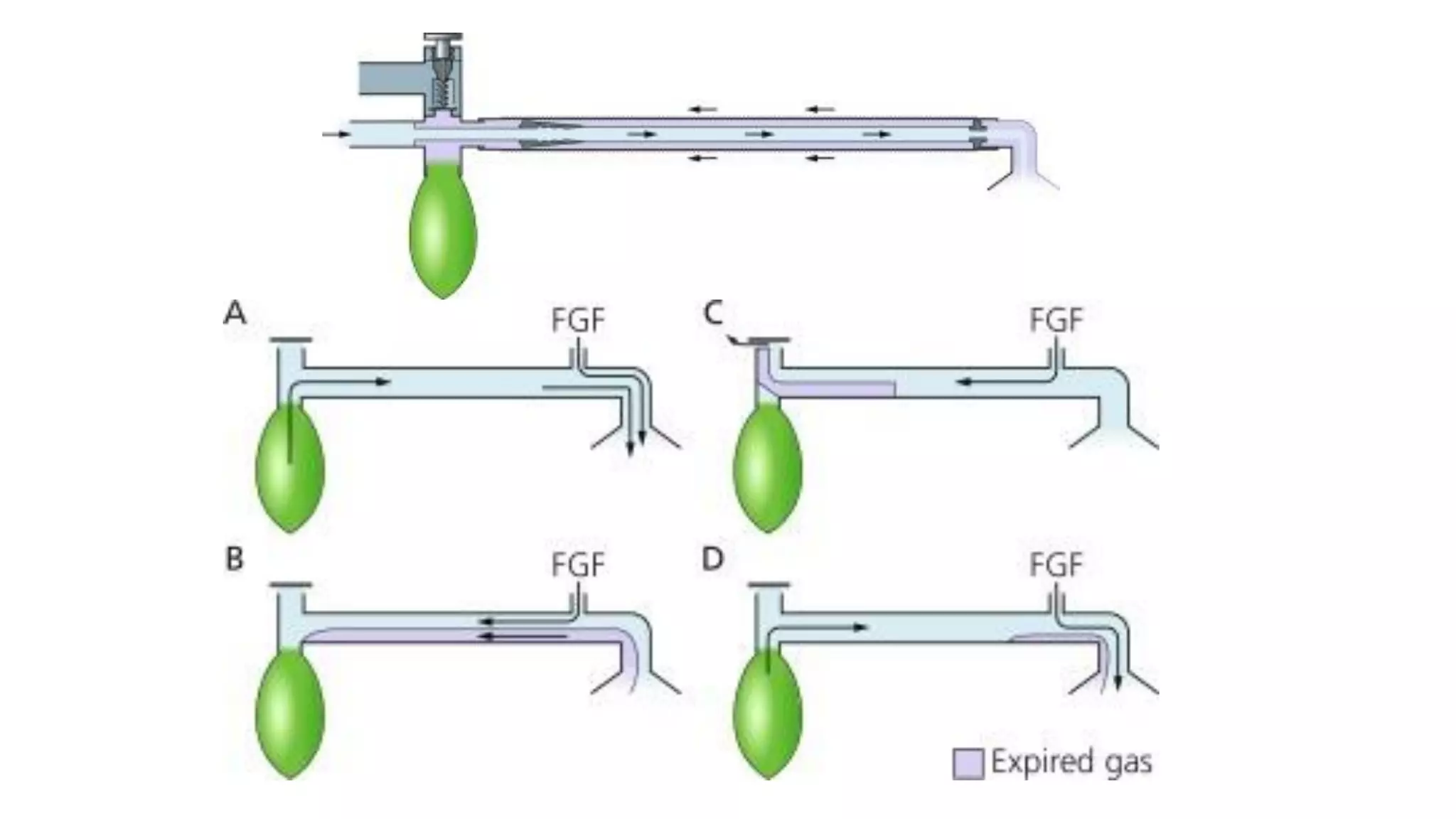 Breathing systems - Mapleson Classification | PDF
