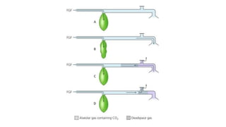 Breathing systems - Mapleson Classification | PDF