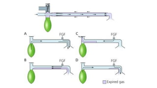 Breathing systems - Mapleson Classification | PDF