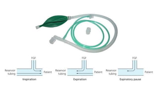 Breathing systems - Mapleson Classification | PDF