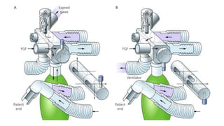 Breathing systems - Mapleson Classification | PDF