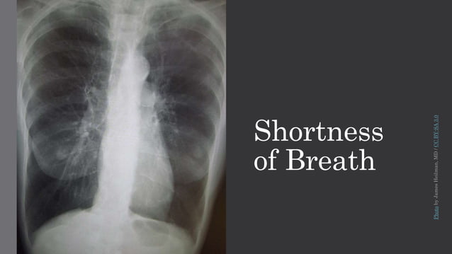 Breathlessness | PPTX | Lung and Respiratory Health | Diseases and ...