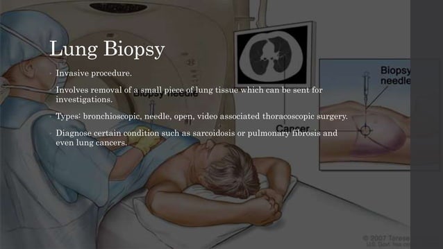 Breathlessness | PPTX | Lung and Respiratory Health | Diseases and Conditions