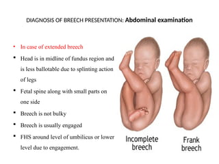Breech presentation, types and its management | PPTX