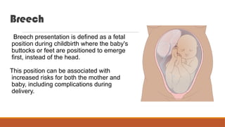 Breech presentation, types, manuvers, definition , diagnosis | PPTX