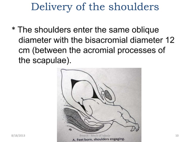 Breech mech of labour | PPTX | Pregnancy | Reproductive Health