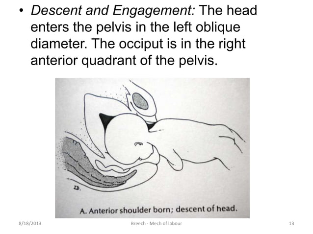 Breech mech of labour | PPTX | Pregnancy | Reproductive Health